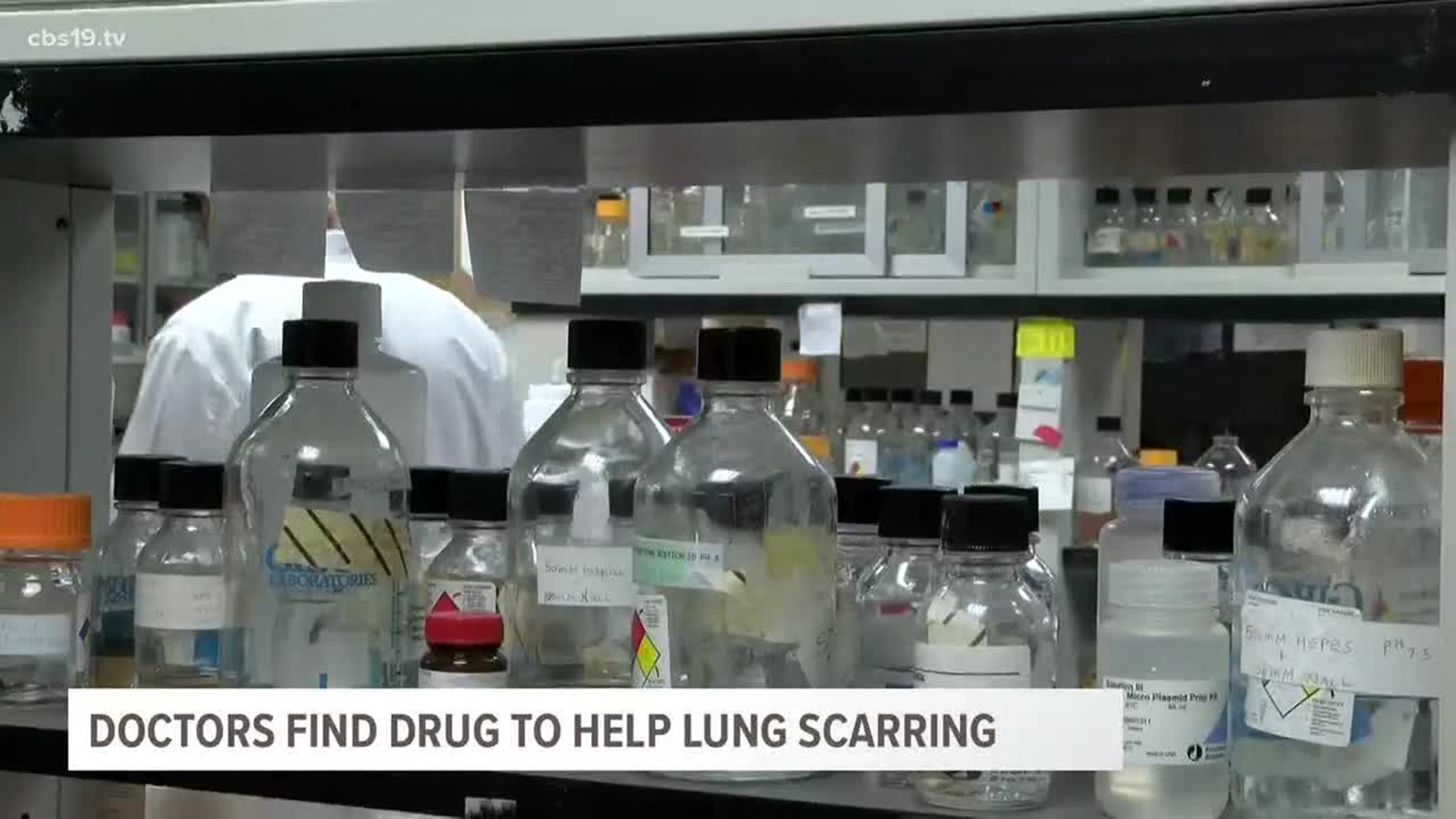 Tyler doctors develop a drug that could reverse lung scarring ...