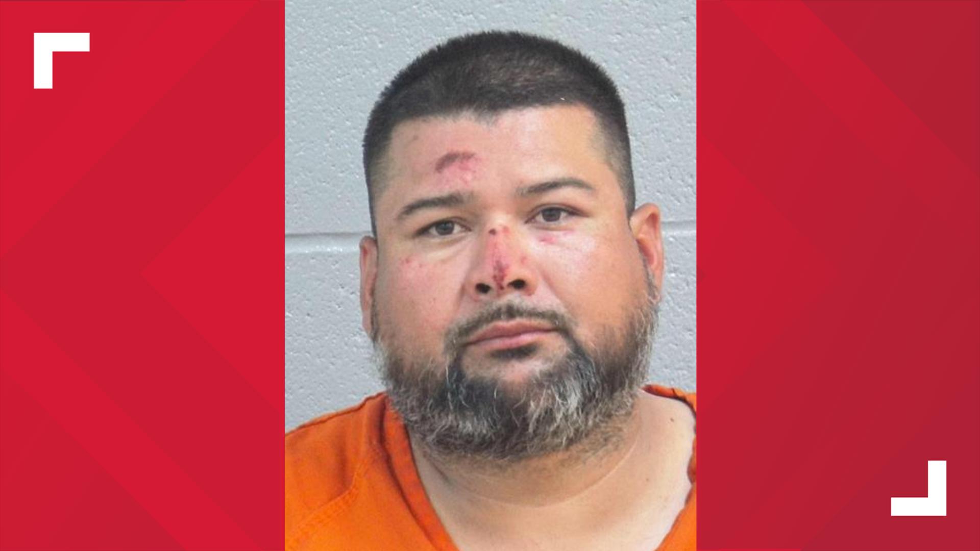 Suspect arrested after allegedly shooting man in the face | newswest9.com